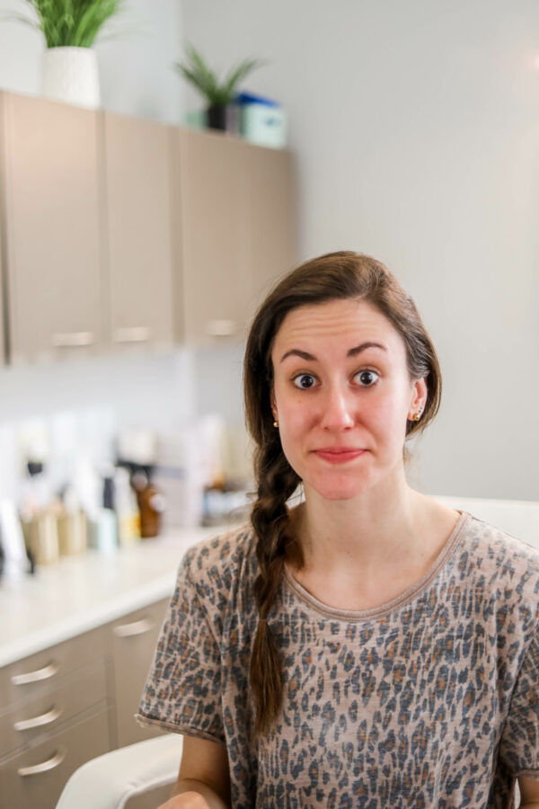 Best Philly Botox - Dr. Christian Subbio (with Botox Before & After Pics!)