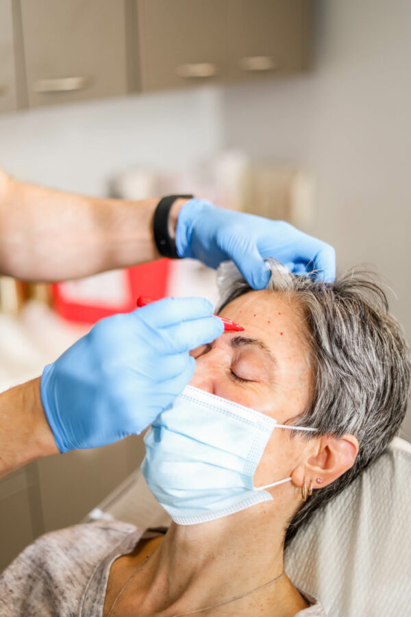 Best Philly Botox - Dr. Christian Subbio (with Botox Before & After Pics!)
